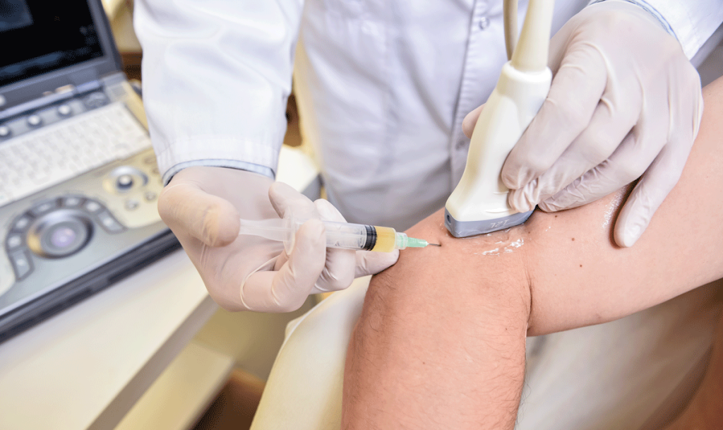 PRP Injections in New York | Mirza Orthopedics